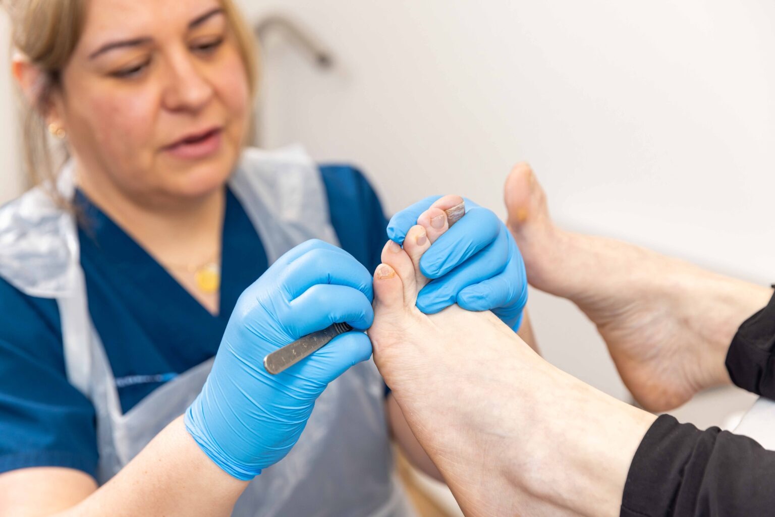 Cracked & Dry Skin - The Foot And Gait Clinic