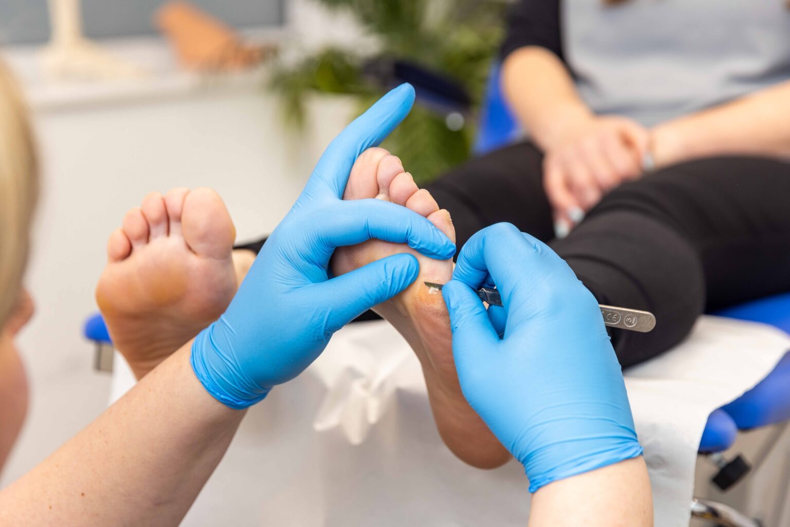 Corns & Callus - The Foot And Gait Clinic
